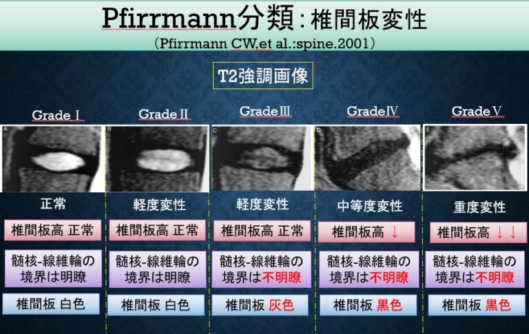 『MRIによる椎間板変性のみかた～Pfirrmann分類～』 | 運動器リハゼミ